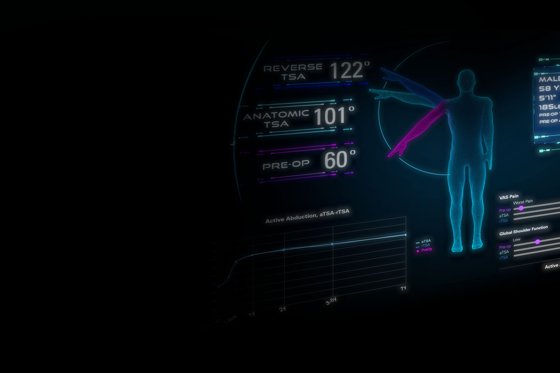 Predict+ | Patient-Specific Outcome Predictor | Exactech